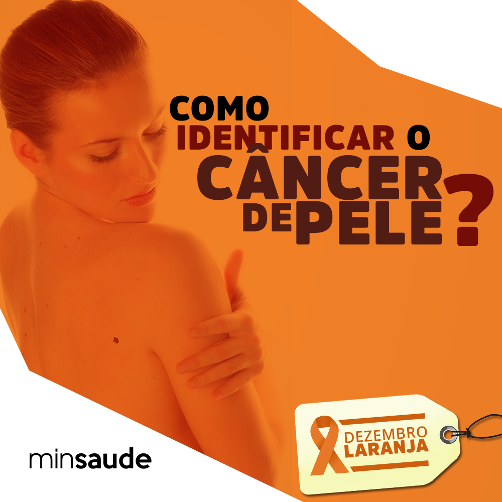 Como identificar o câncer de pele? | INCA - Instituto Nacional de Câncer Como identificar o câncer de pele? | INCA - Instituto Nacional de Câncer