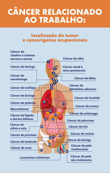 Câncer relacionado ao trabalho | INCA - National Cancer Institute